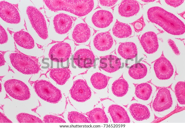 Cross Section Human Testis Under Microscope Foto stock 736520599 ...