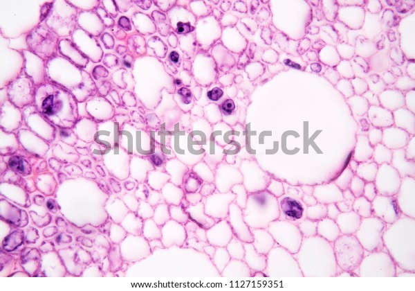 Cross Section Monocot Root Tip Under Foto de stock 1127159351 ...