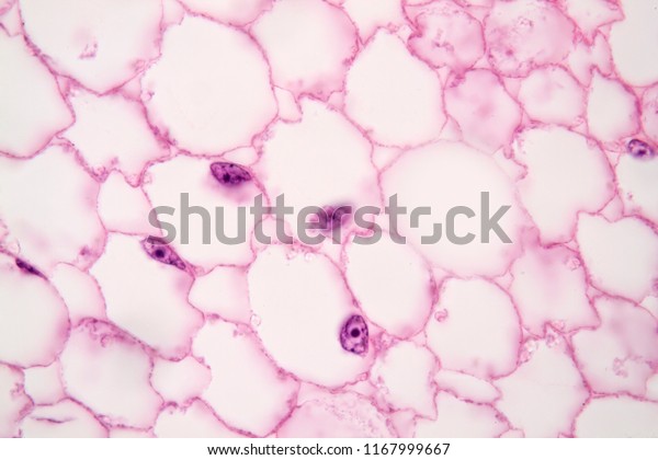 Cross Section Monocot Root Tip Under 스톡 사진 1167999667 | Shutterstock