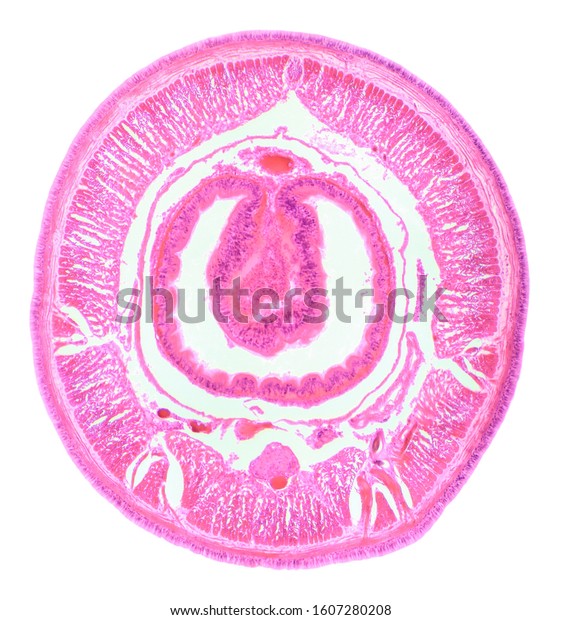 Cross Section Planarian Under Microscope Planaria Stockfoto 1607280208 ...