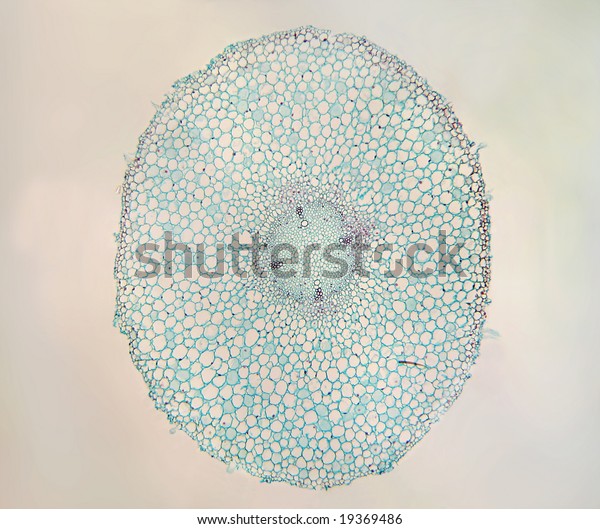 Cross Section Root Broad Bean Vicia Stock Photo 19369486 | Shutterstock