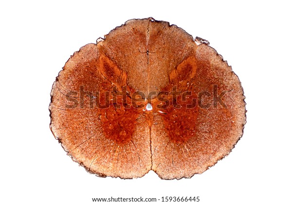 Cross Section Spinal Cord Under Microscope Stock Photo 1593666445 ...