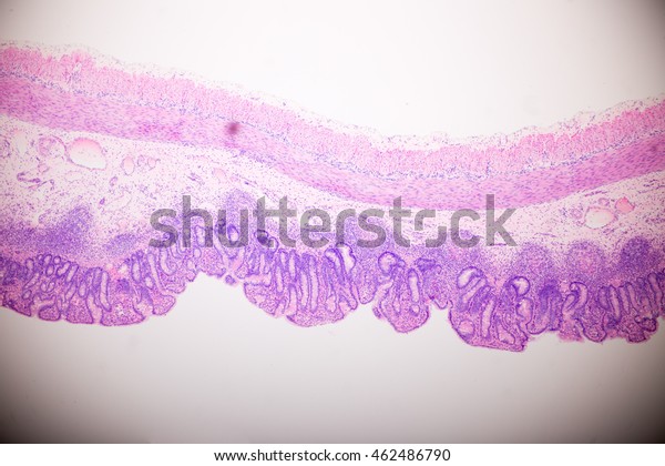 Cross Section Stomach Tissue Microscopic View Stock Photo (Edit Now ...