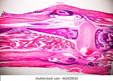 Cross Section Tendons Tissue Bone Under Stock Photo 462420010 ...