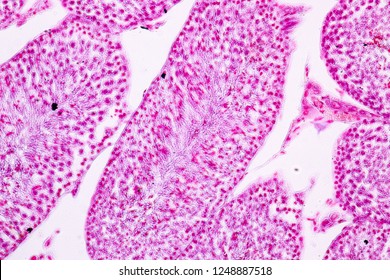 357 Cross section of the testis Images, Stock Photos & Vectors ...