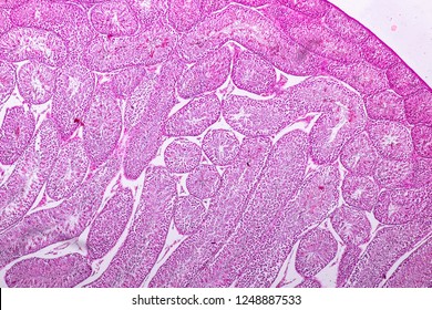 357 Cross section of the testis Images, Stock Photos & Vectors ...