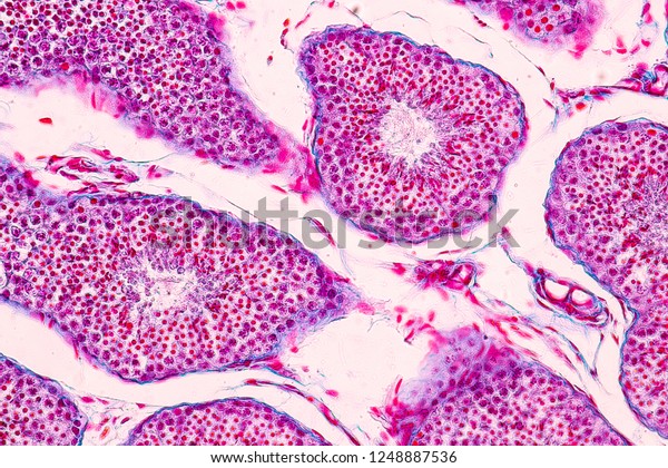 Cross Section Testis Tissue Under Microscope Foto de stock 1248887536 ...