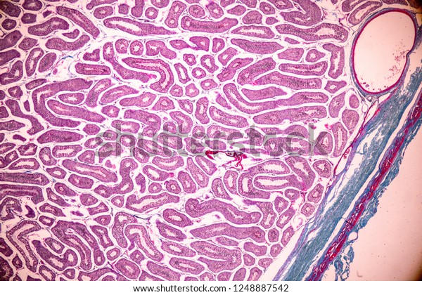 Cross Section Testis Tissue Under Microscope Foto De Stock 1248887542