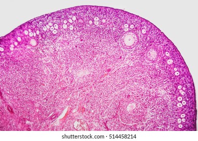 27 Rete testis Images, Stock Photos & Vectors | Shutterstock