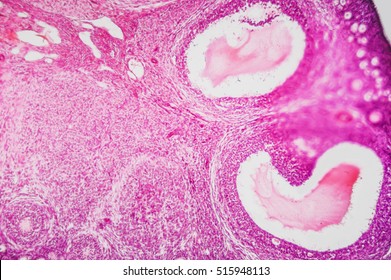27 Rete testis Images, Stock Photos & Vectors | Shutterstock