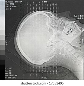 Ct Scan Angles Stock Photo 17551405 | Shutterstock