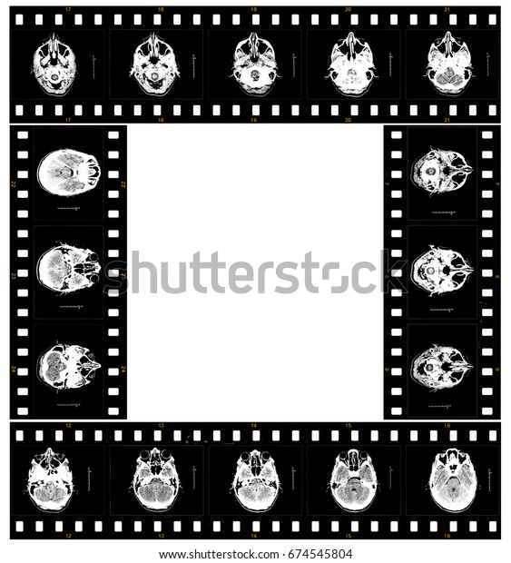 Ct Scan Human Skull Brain Film Stock Photo 674545804 | Shutterstock