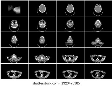 Ct Scan Step Set Upper Neck Stock Photo 1323493385 | Shutterstock
