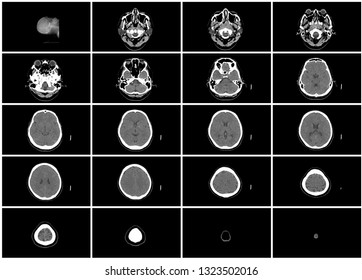 Ct Scan Step Set Upper Brain Stock Photo 1323502016 | Shutterstock