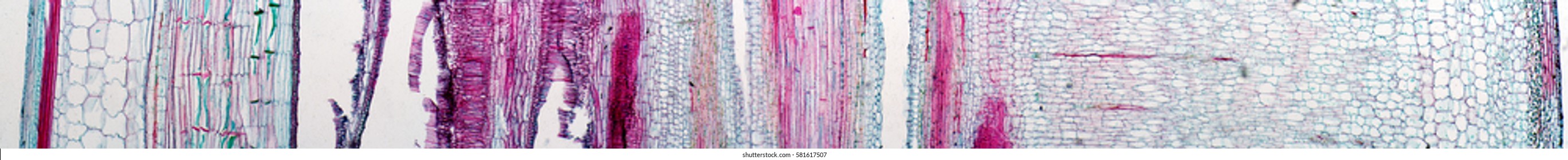 20 Pumpkin under microscope Gambar, Foto Stok & Vektor | Shutterstock