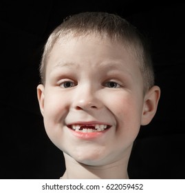1,414 Missing Teeth Funny Images, Stock Photos & Vectors | Shutterstock