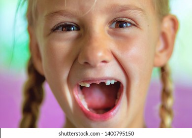 2,480 Missing front teeth Images, Stock Photos & Vectors | Shutterstock