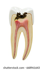Tooth Cross Section Model Stock Photo (Edit Now) 1244903923