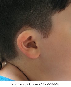 506 Deformed ear Images, Stock Photos & Vectors | Shutterstock
