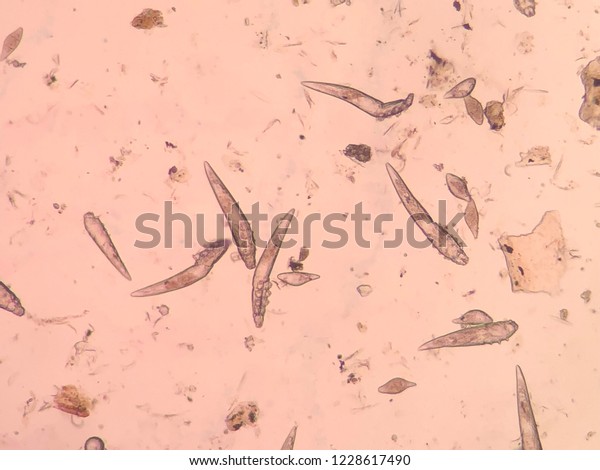 Demodex mange de una vista del Foto de stock 1228617490 | Shutterstock