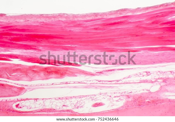 Dense Regular Connective Tissue Light Photomicrograph Stock Photo ...