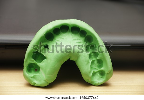 Dental Impression Maxillary Teeth Using Elastomer Stock Photo ...