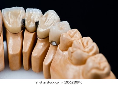 Tailbone Pain Relief Coccydynia Coccyx Pain Stock Photo (Edit Now ...
