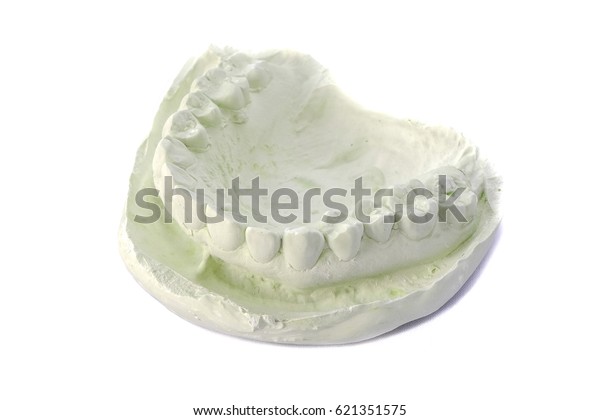 Dental Study Cast Working Model Upper Stock Photo 621351575 | Shutterstock