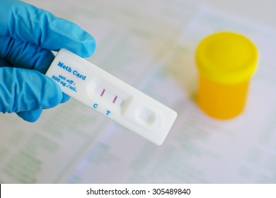 Detection Methamphetamine Urine By Using Test Stock Photo 306082340 ...