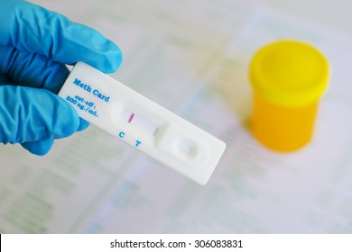 Detection Methamphetamine Urine By Using Test Foto stock 306083831 ...