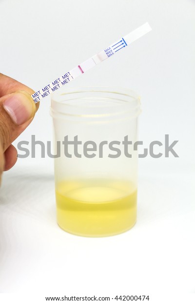 Detection Methamphetamine Urine By Using Test Stock Photo 442000474 ...
