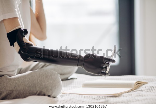 Development Prosthetic Arm Systems Prosthetic Hand Stock Photo ...