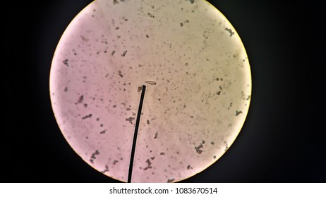 Diatom Under Microscope Stock Photo (Edit Now) 1083849836