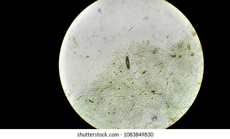 Crystal Sheeth Senna Leaf Under Light Stock Photo (Edit Now) 1260894562 ...