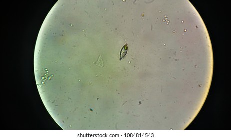 Diatom Under Microscope Stock Photo 1084814543 | Shutterstock