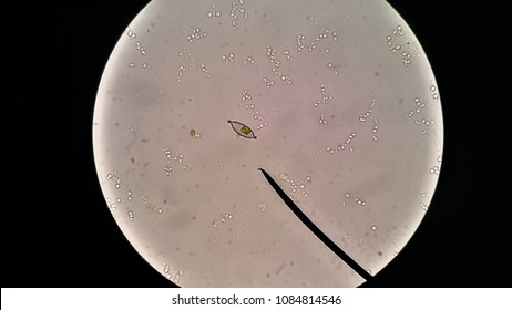 Diatom Under Microscope Stock Photo (Edit Now) 1084814546