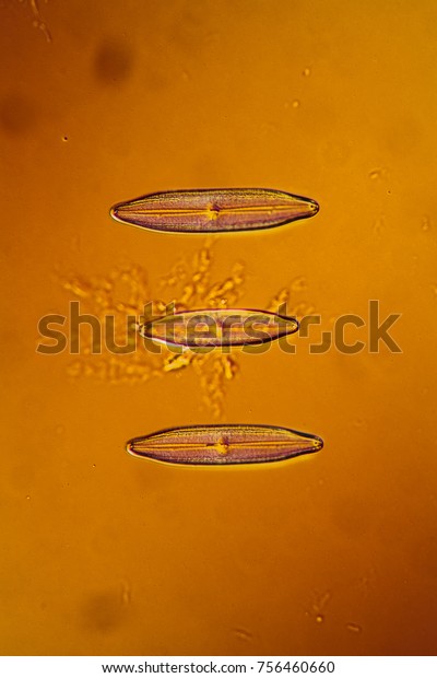 Diatoms Under Microscope Stock Photo 756460660 | Shutterstock