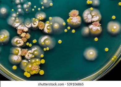 Difference Colony Actinomyces On Selective Media 스톡 사진 539106865 ...