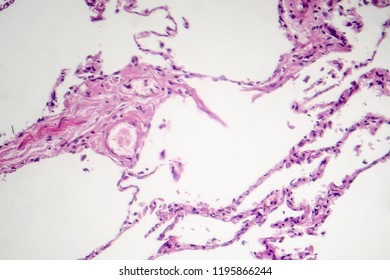 Photo de stock Human Lung Tissue Under Microscope View 1342237958 ...