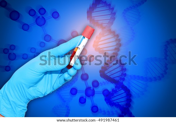 Стоковая фотография 491987461: Dna Testing Blood Laboratory Blood ...