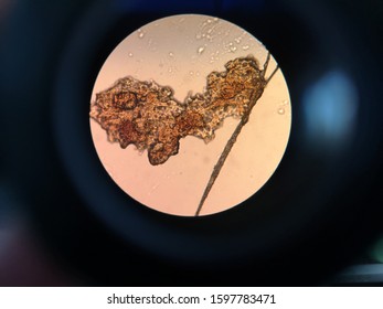 Ear Mite Microscope Stock Photo 1597783471 | Shutterstock