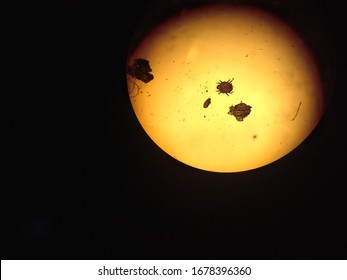 Ear Mite Under Microscope Stock Photo 1678396360 | Shutterstock