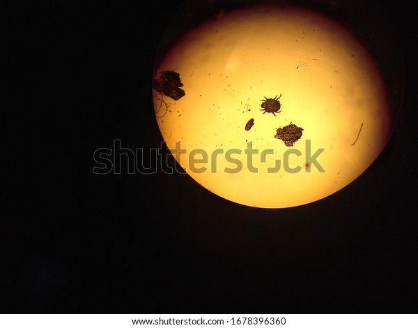 Ear Mite Under Microscope Stock Photo 1678396360 | Shutterstock