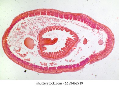 Earthworm Cross Section Under Microscope Stock Photo 1653462919 ...
