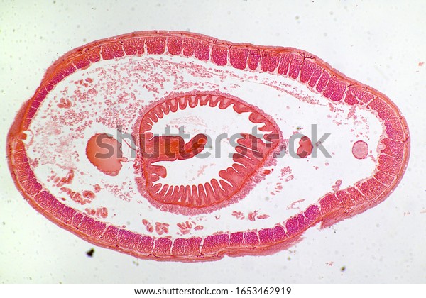Earthworm Cross Section Under Microscope库存照片1653462919 | Shutterstock