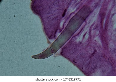 "Earthworm under microscope" - 101 Ảnh, vector và hình chụp có sẵn ...