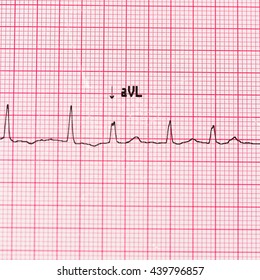 Ecg Graph Electrocardiogram Ecg Stock Photo 439796857 | Shutterstock