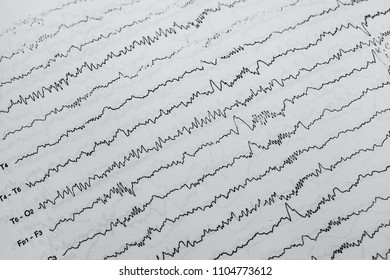Eeg Patients Problems Electrical Activity Brainabnormal Stock Photo ...
