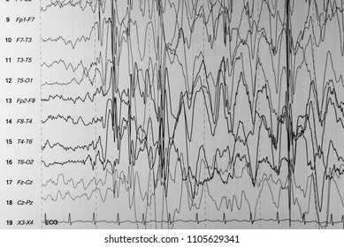 Brain Wave On Electroencephalogram Eeg Epilepsy Stock Photo (Edit Now ...