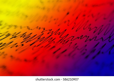 Eeg Wave Backgroundbackground Abnormal Eegbrain Wave Stock Photo ...